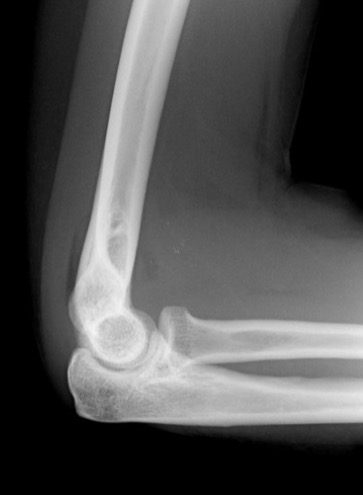 Orthopedic Injuries