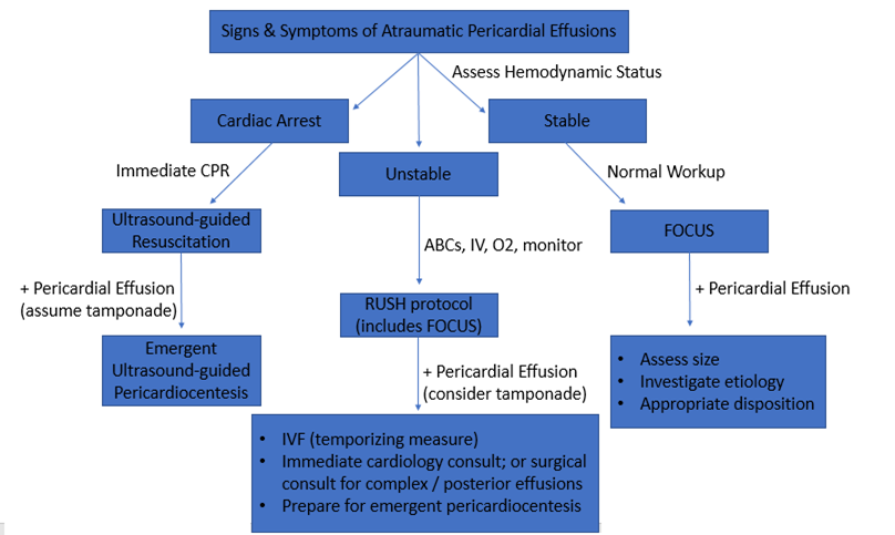 Pericardial effusion
